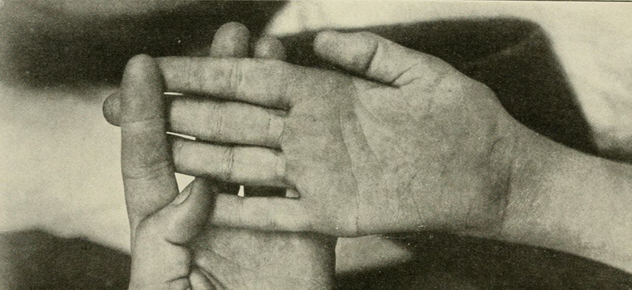 Adda Stories: I Am Not My Skin - Commonwealth Foundation